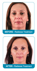 Jeff Nourse, of New You Spa Talks of Radiesee Benefits, the Only Dual ...