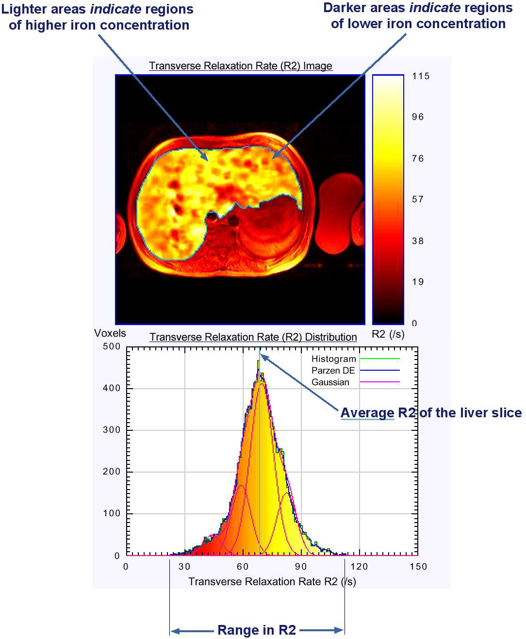 International Multicentre Study Confirms Accuracy and Clinical ...
