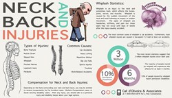 Lawyers Release New Informational Graphic about Compensation for Neck ...
