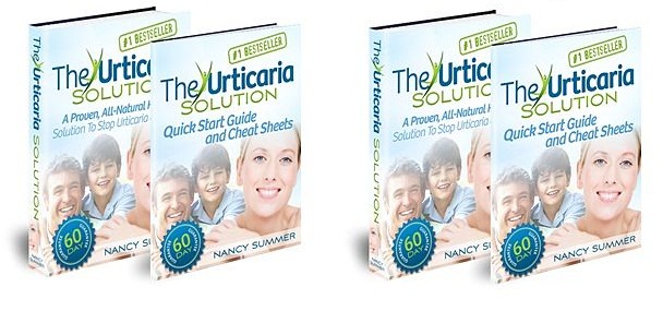 Urticaria Solution Review | Learn How To Treat Urticaria Or Hives ...
