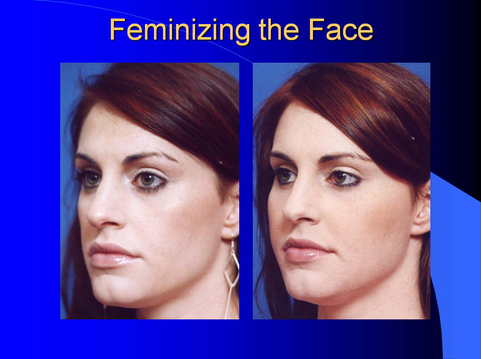 Richard Ellenbogen's Instagram, Twitter & Facebook on IDCrawl