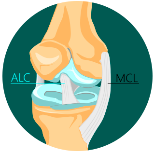 New Conservative Approach For Treatment and Rehabilitation of ACL Injuries