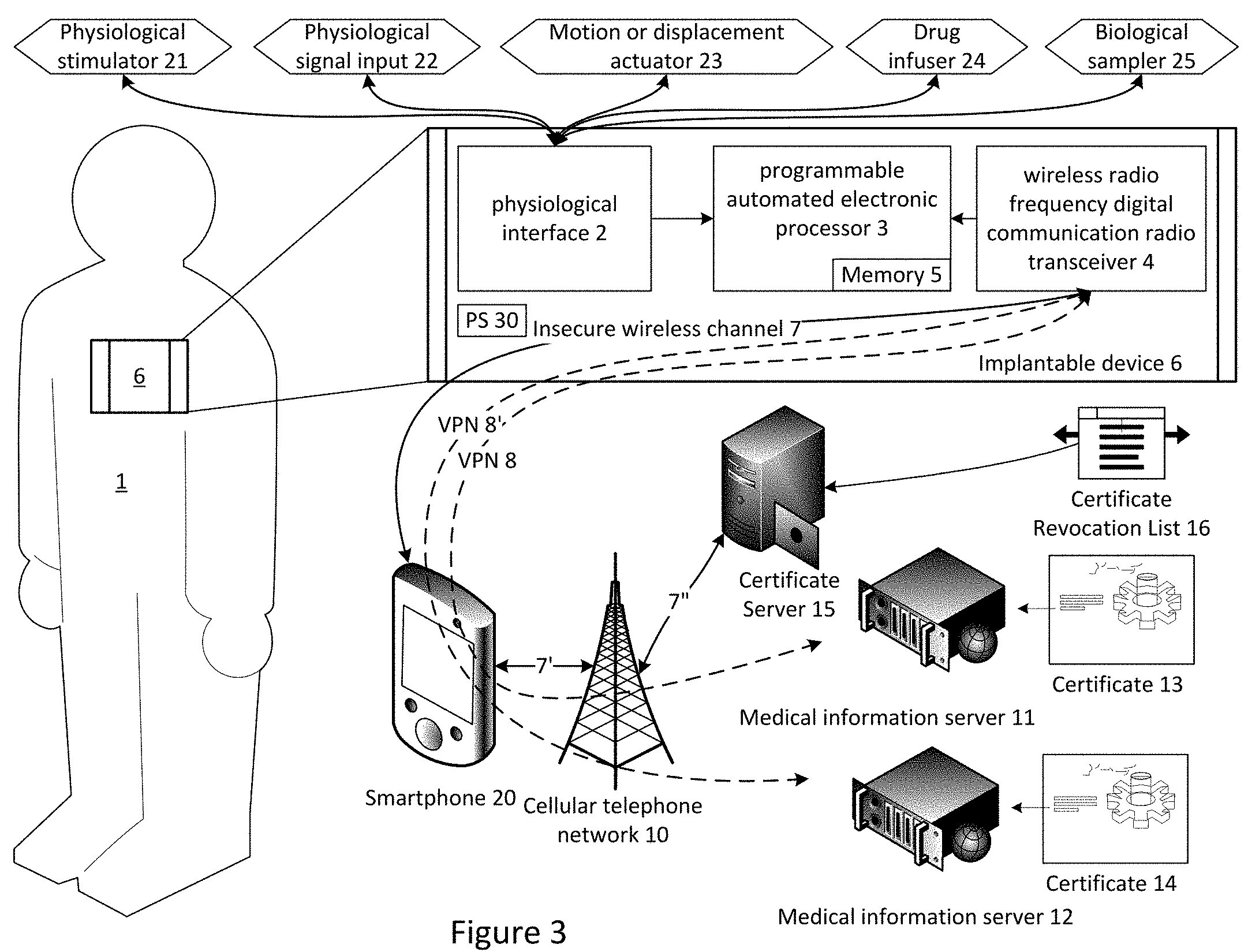 Implant Secure Communications Awarded U.S. Patent Directed to Secure ...