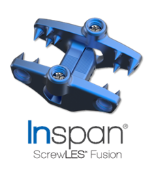 5-Year Follow-Up Outpatient of L4-L5 Fixation with Inspan Device for ...