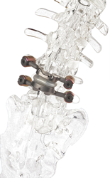 Premia Spine TOPS™ System Achieves FDA Premarket Approval with ...